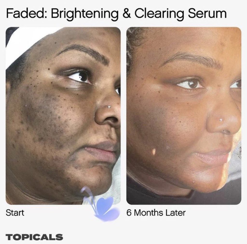 TOPICALS - FADED Serum Anti Taches - Wurus Beauty